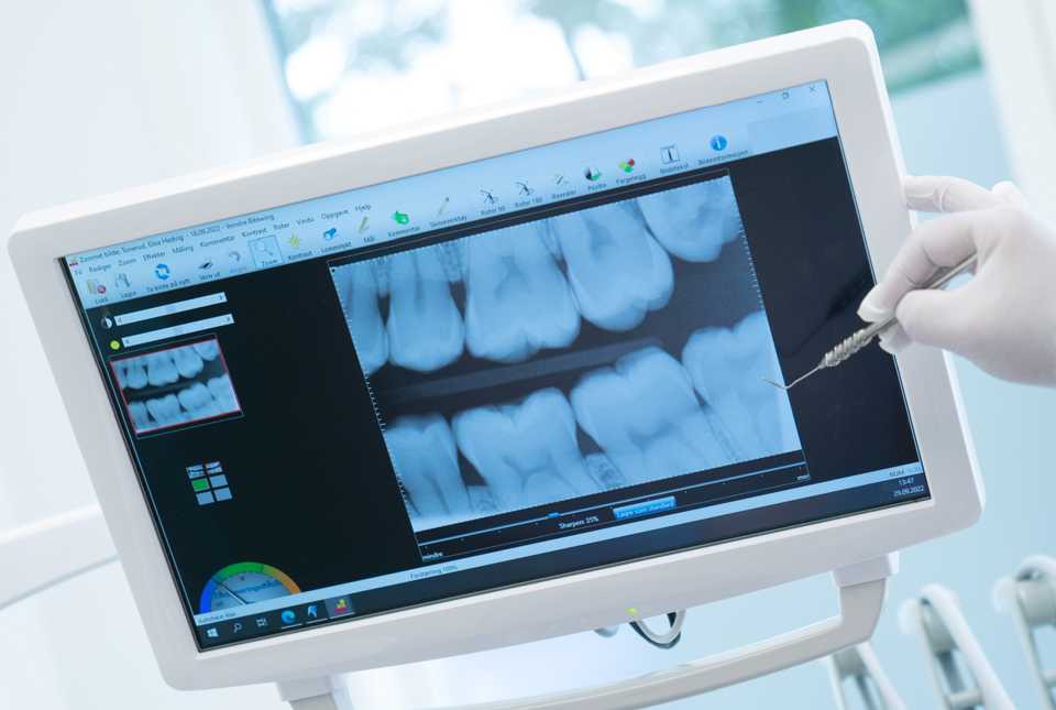 Røntgen av tenner | Priser og timebestilling | Tannfeen