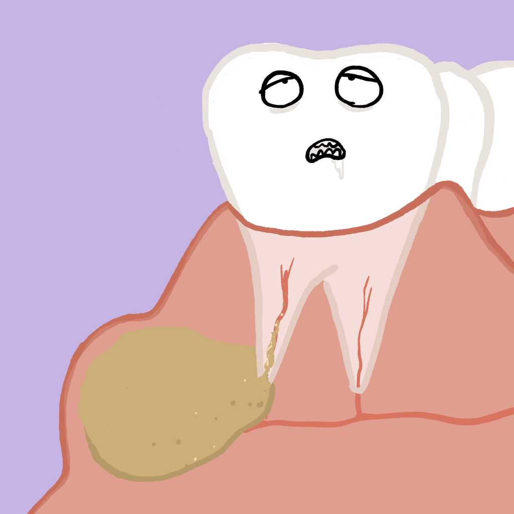 Hva hjelper mot tannverk? Smertelindring og behandling - Tannfeen